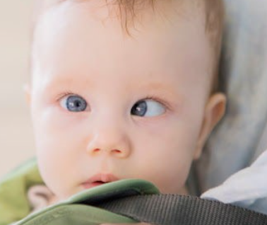 Is Squint Eye also called Strabismus? | by Praveenamajety | Medium