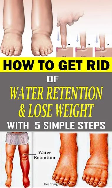 How to Get Rid of Water Retention and Lose Weight With 5 Simple Steps ...