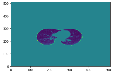 Analisis Citra CT Scan dengan Image Segmentation | by Nurlaila Tan | Medium