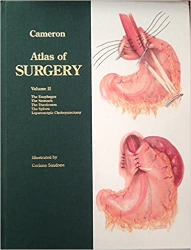 READ/DOWNLOAD$= Atlas of Surgery: The Esophagus, t | by READ/DOWNLOAD ...