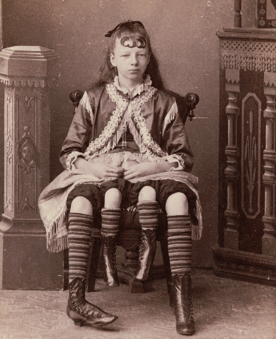 Top 10 Most Famous Freak Show Performers In History | by BORED | Medium