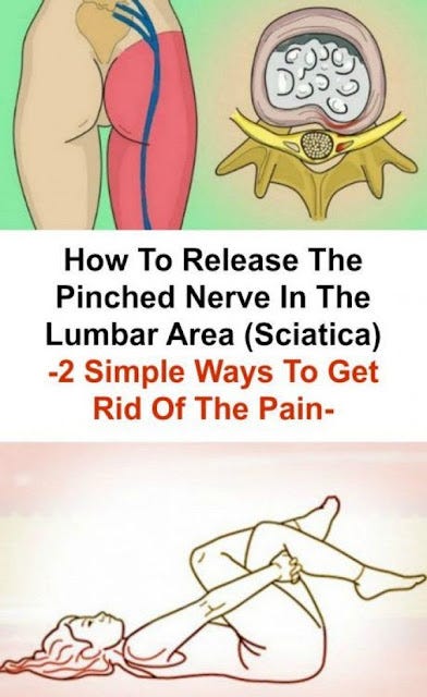 How to Release the Pinched Nerve in the Lumbar Area (sciatica)- 2 ...