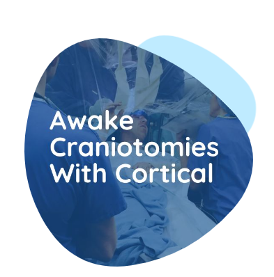 Awake Craniotomies With Cortical - Dr. Akbar Khan - Medium