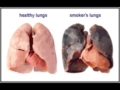 I. Introduction:. Smoking is the act of inhaling and… | by HEALTH AND ...