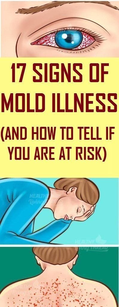 17 Signs of Mold Illness and How to Tell If You Are at Risk - Donna ...