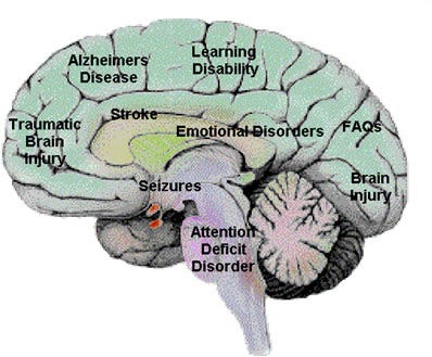 Topic: All About Intellectual Disability. | by Quratulain | Medium