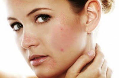 Top 8 Causes of Black Spots On Face | by Healthcare Kingdom | Medium