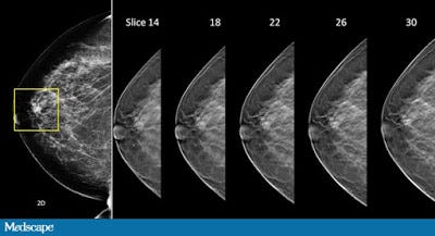 Strategic Report on Breast Imaging Market with Major Players include ...