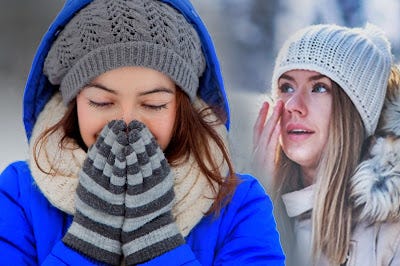 SS5 Tips to Protect Your Skin From the Harsh Winter Elements | by ...