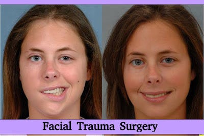 The different locations in the US to get the facial trauma surgery done ...