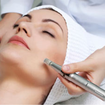 Nano Needling - Acuquerque - Medium