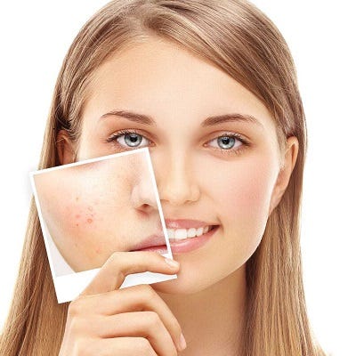 Unveiling Your True Beauty: Facial Scar Revision as a Transformative ...