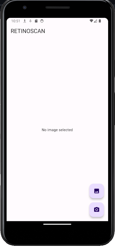 Embedding ML Model in Flutter App | by Ameycorporates | Medium