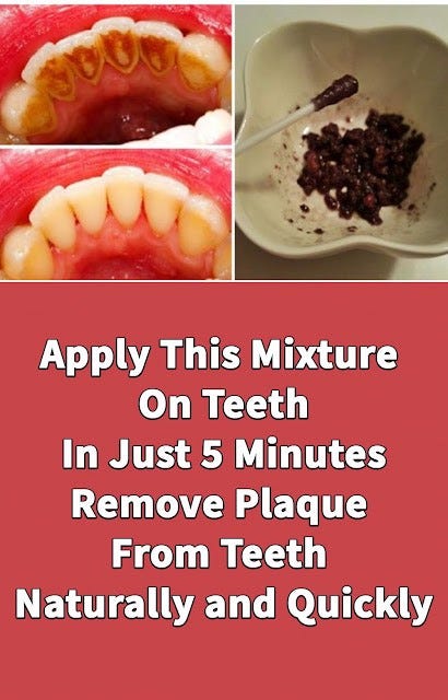 How to Remove Teeth Plaque At Home, Tips to Control Tartar - DR.ASKY ...