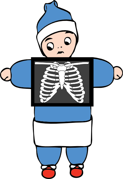 The X-Ray Prototype. How to make the most of your… | by Prashant ...