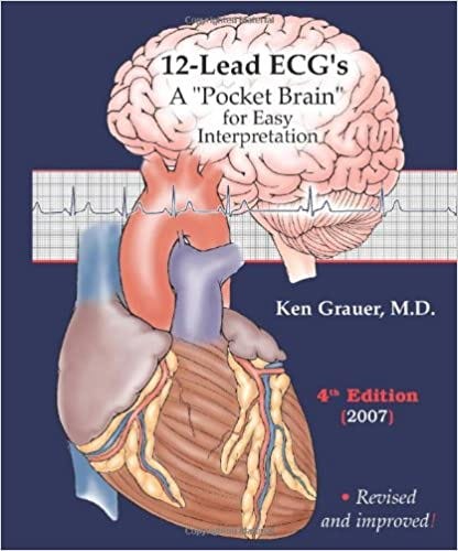 READ/DOWNLOAD=? ECG Pocket Guide (Pocket Brain) - | by READ/DOWNLOAD ...