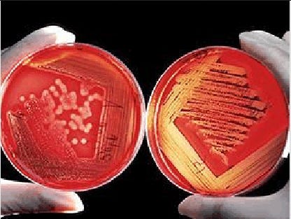 Understanding MRSA Screening: What You Need to Know | by Meidike Gene ...