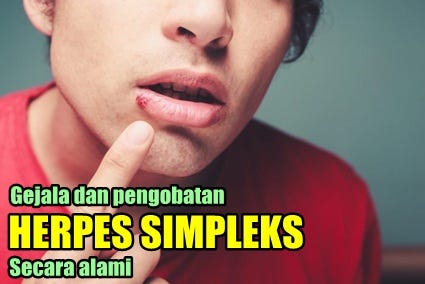 Obat Gatal Herpes Simplex. Obat gatal herpes simplex — Penyakit… | by ...