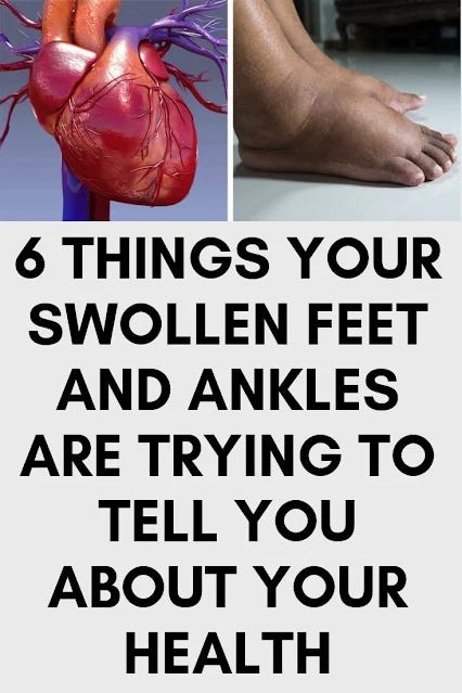 6 Things Your Swollen Feet And Ankles Are Trying To Tell You About Your ...