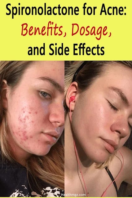 Spironolactone for Acne: Benefits, Dosage, and Side Effects - Emily ...