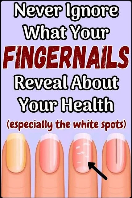 This Is What Your Fingernails Say About Your Health - Mary odonnell ...