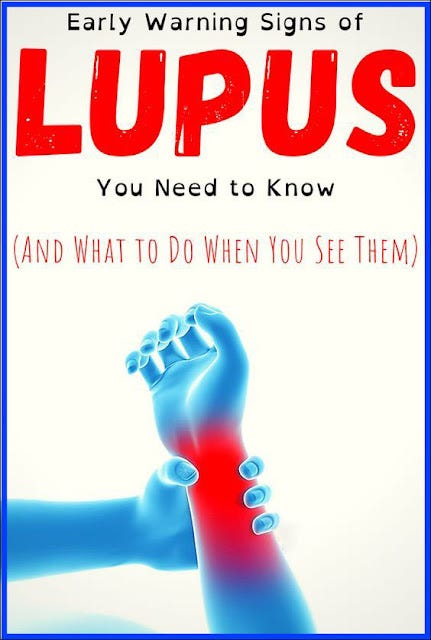 13 Early Warning Signs of Lupus You Need to Know (and what to do the ...