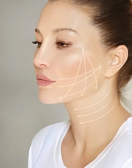 Thread Lift Treatment - 9m clinic - Medium