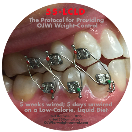 Overcoming Hesitancy to Provide a Weight-Control Service in the Dental ...