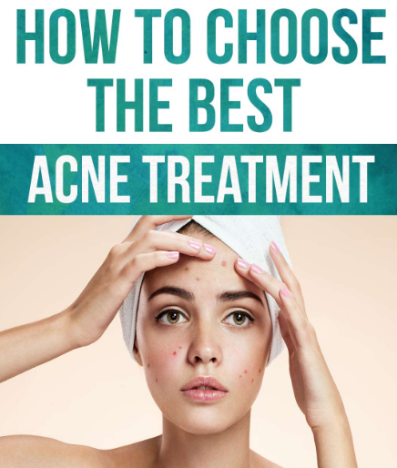 What Type of ACNE do you have?. Acne is chronic skin condition… | by ...