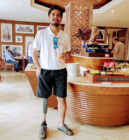 Beyond Limitations: Discovering The Benefits of Below Knee Artificial ...