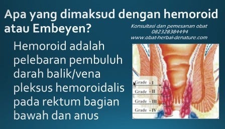 Cara Menghilangkan Wasir Atau Ambeien | by Najib nay | Medium