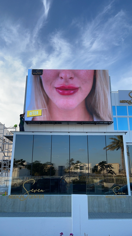 outdoor normal screen - Liu Li - Medium