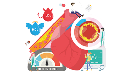 Lipid Profile Tests In Bopal, Ahmedabad | Total Cholesterol | TG | HDL ...