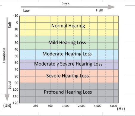 KNOW YOUR HEARING LOSS LEVELS BETTER | by Spiethracking | Medium
