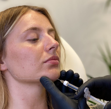Jawline Augmentation Services at Halcyon Medispa in London | Medium