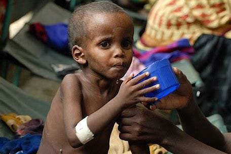 Understanding Malnutrition and Food Safety for the Underprivileged and ...