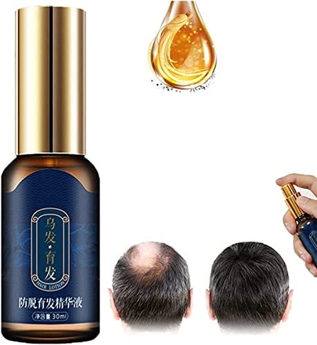 ZOKU-HGP Hair-Tonic Spray,Polygonum Multiflorums Hair Growth Serum ...