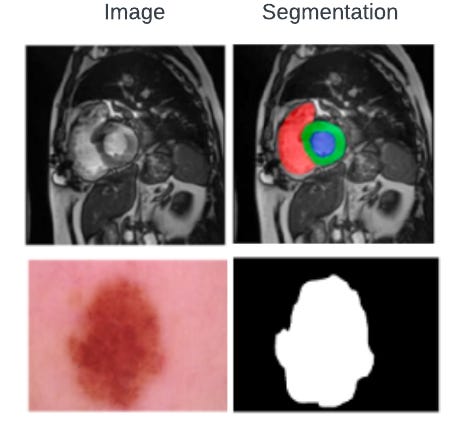 Semi-supervised Deep Learning for Medical Image Segmentation | by ...