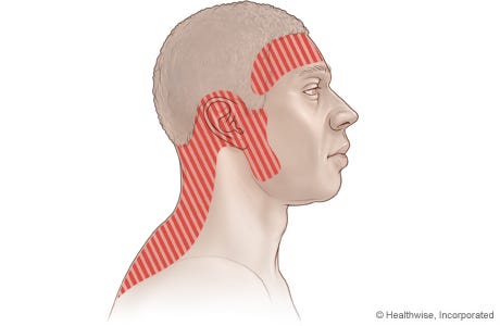 A Deep Dive into Tension Headaches. Causes, Symptoms and Treatment ...