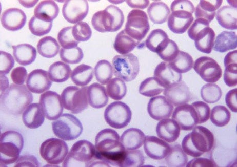 What Does Malaria Look Like Under A Microscope