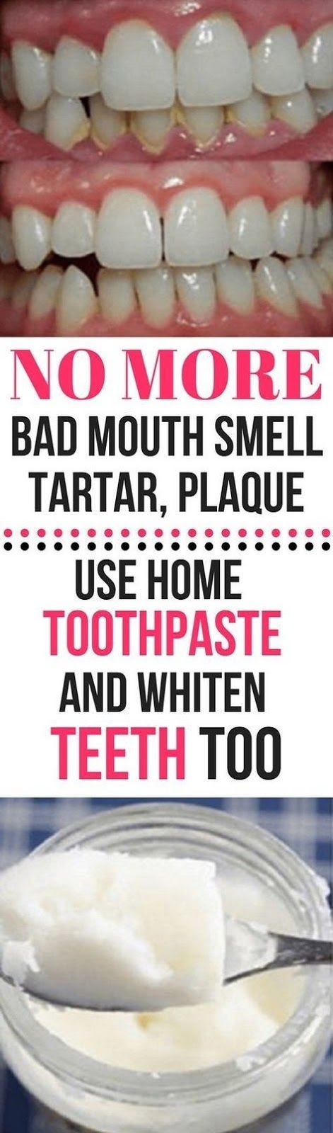 No More Bad Mouth Smell, Tartar, Plaque Using This Best Home Teeth ...