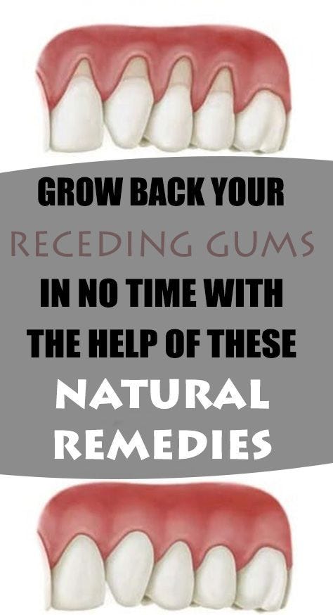 Grow Back Your Receding Gums With The Help Of These Natural Remedies ...