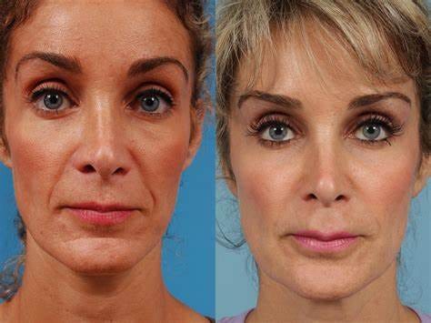 5 Major Plastic Surgery Benefits. Individuals who decide to go through ...