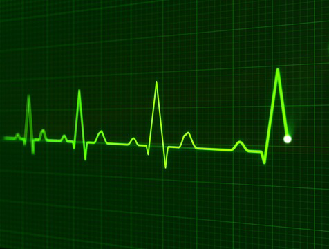 Info Kursus EKG. EKG & jenis utamanya | by EKG Perki Jaya | Medium