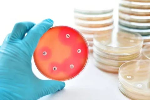 Antimicrobial Susceptibility Testing An Essential Tool for Effective ...
