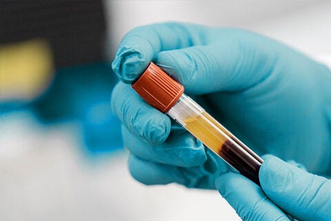 Benefits of lab test in treatment | by Molecularlabsin | Medium