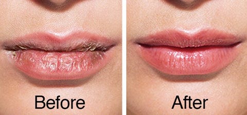 7 Step Guide for Naturally Beautiful Lips | by Dmberomt | Medium