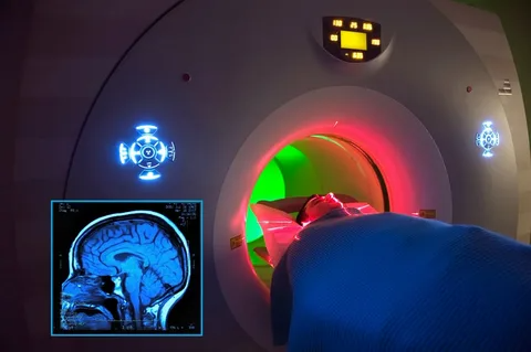 Magnetic Resonance Imaging (MRI) Contrast Agents Market |Industry ...