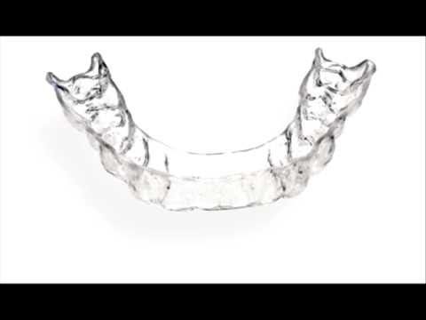 Convenient Smiles | Order Retainers Online for Easy Post-Orthodontic ...