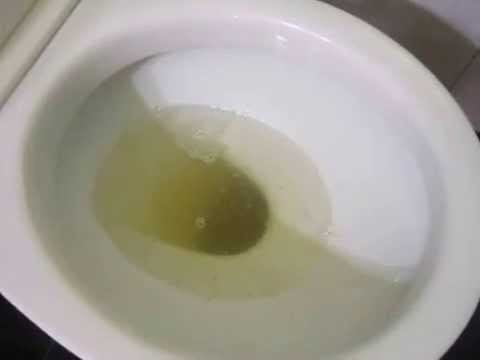 Esta es la solución más barata para tu inodoro atascado - hoyensalud ...